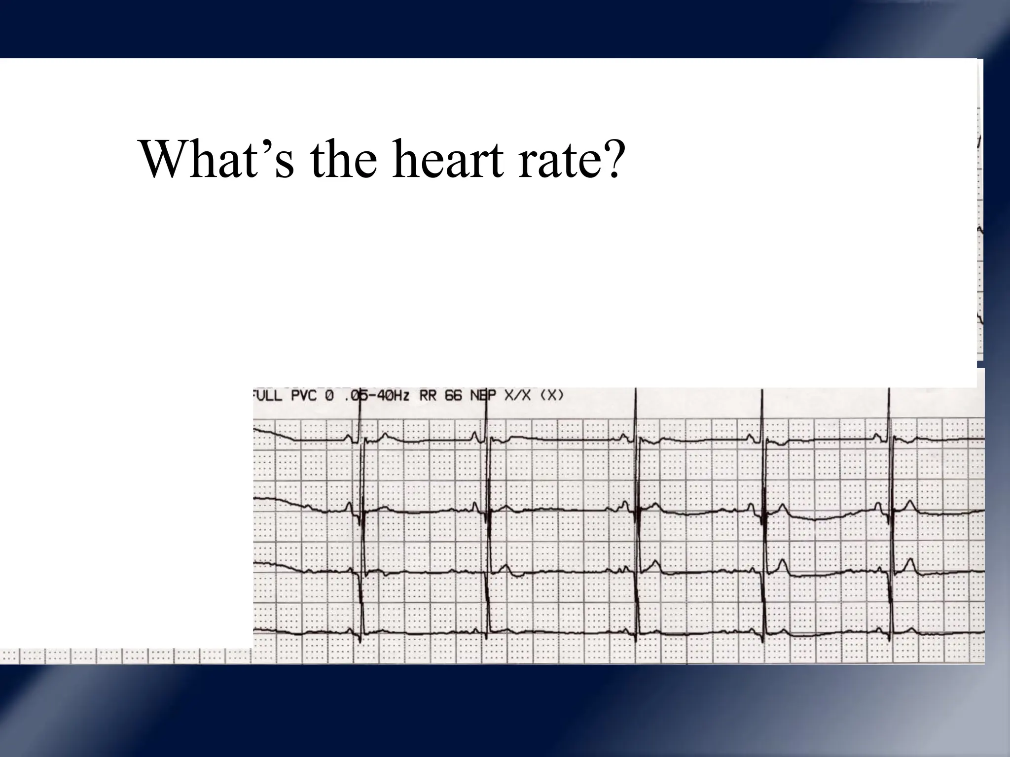 Pediatric EGC interpretation... Overview of pediatric ECG | PDF