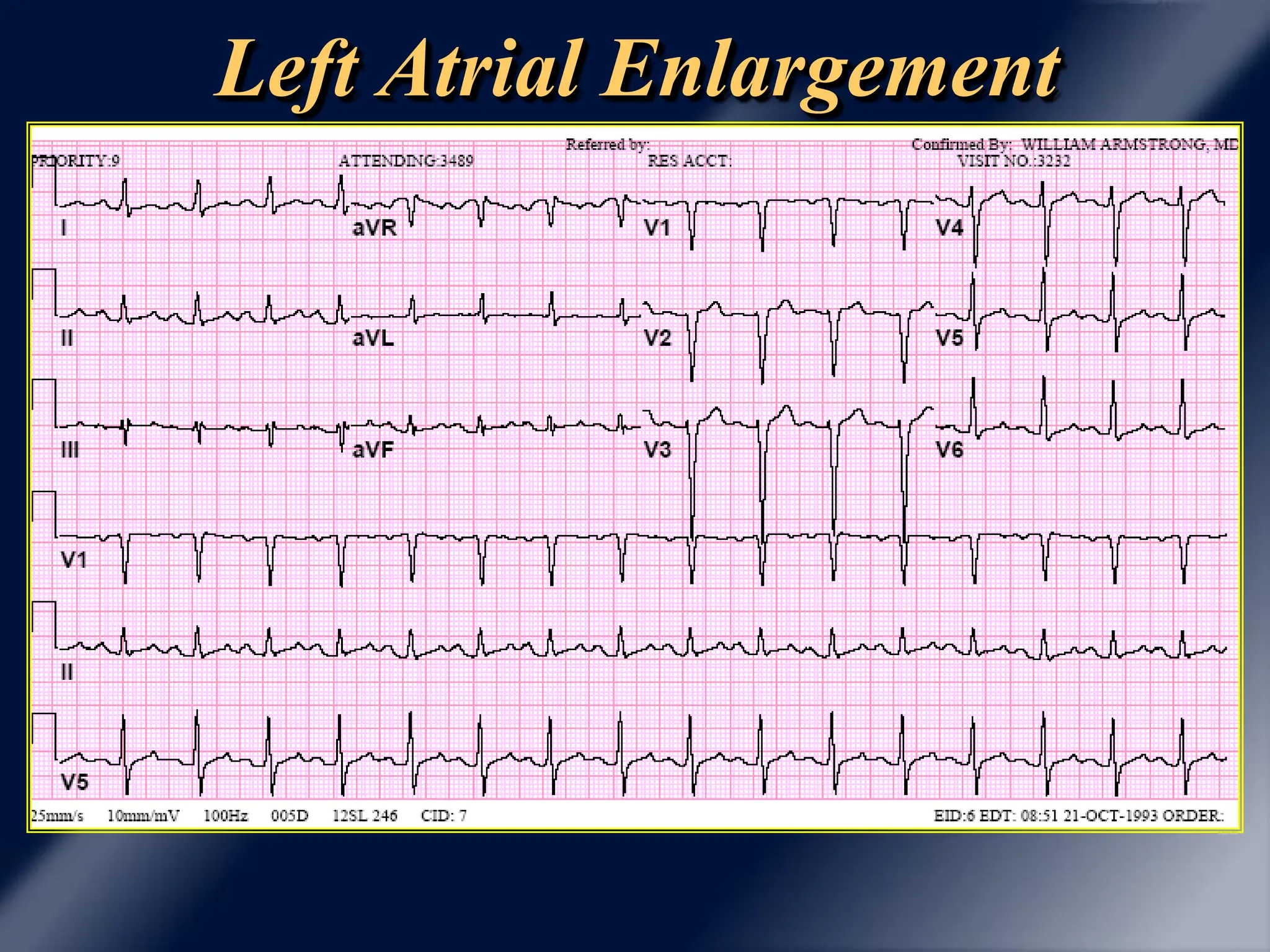 Pediatric EGC interpretation... Overview of pediatric ECG | PDF