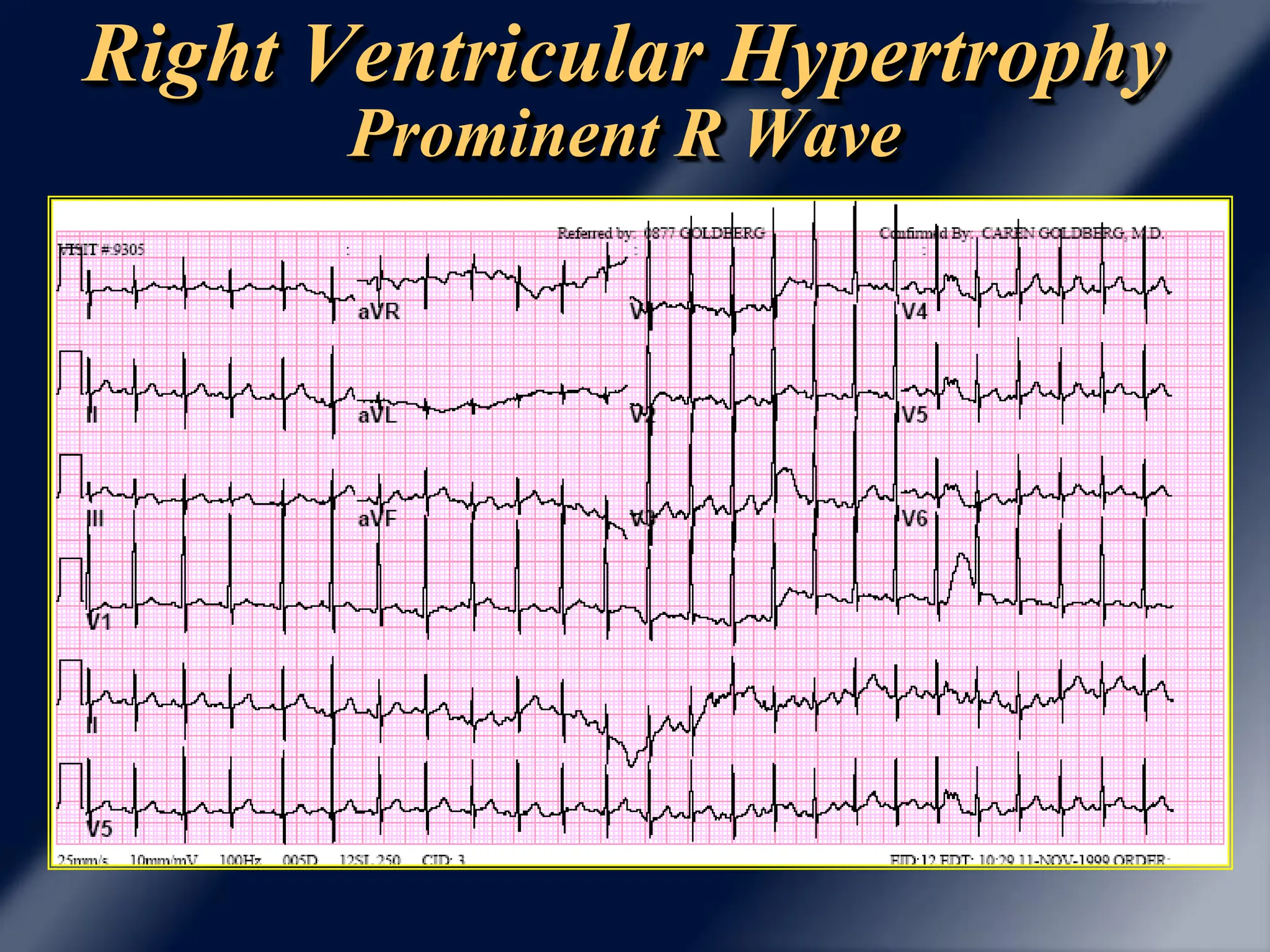 Pediatric EGC interpretation... Overview of pediatric ECG | PDF