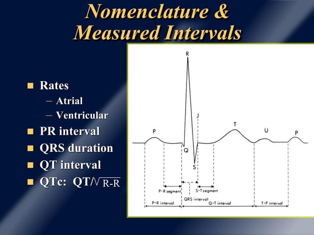 Pediatric EGC interpretation... Overview of pediatric ECG | PDF