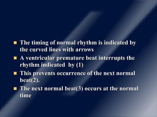 Pediatric EGC interpretation... Overview of pediatric ECG | PDF