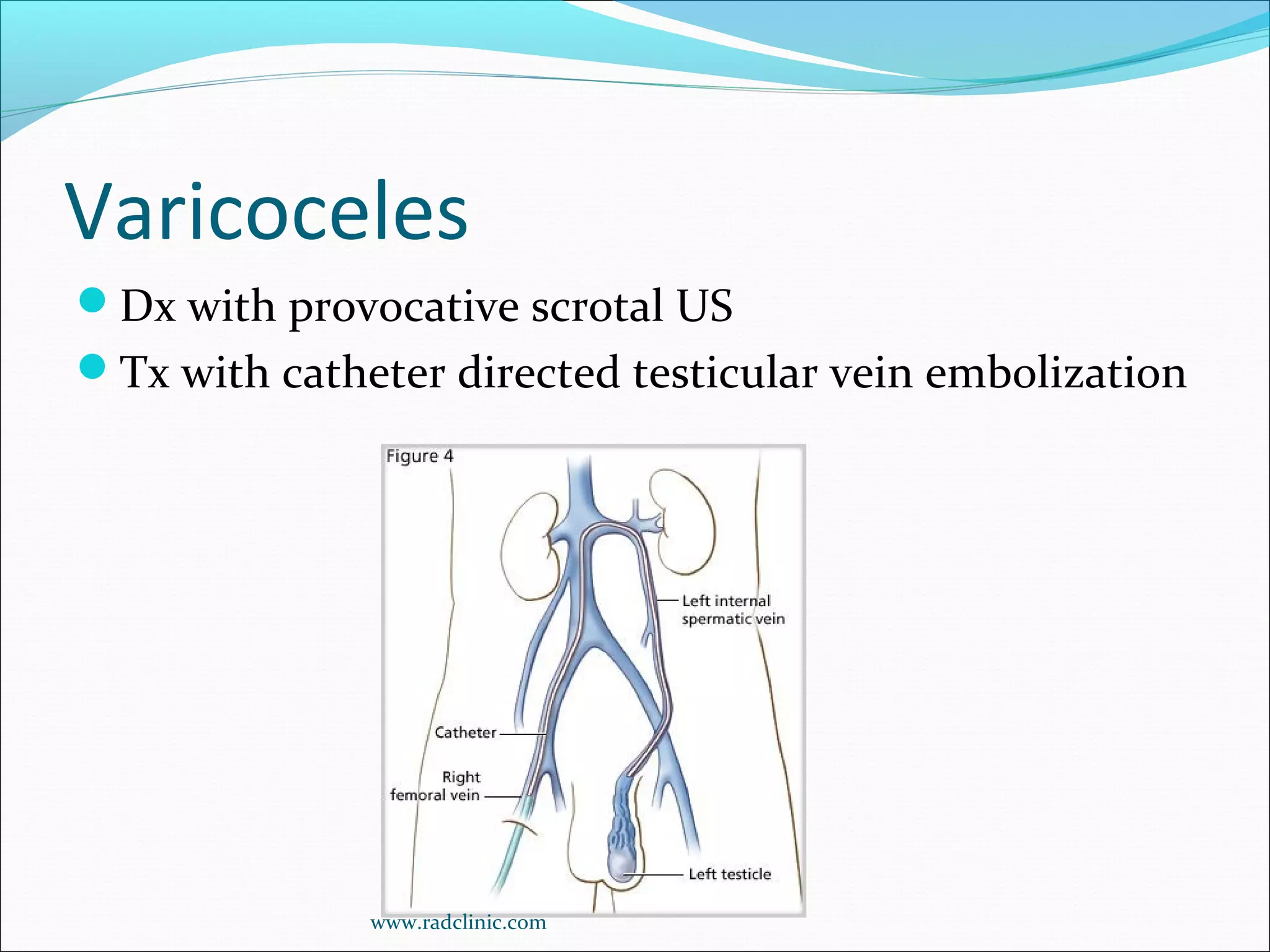 Current applications of interventional radiology 97 | PPT