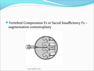 Current applications of interventional radiology 97 | PPT