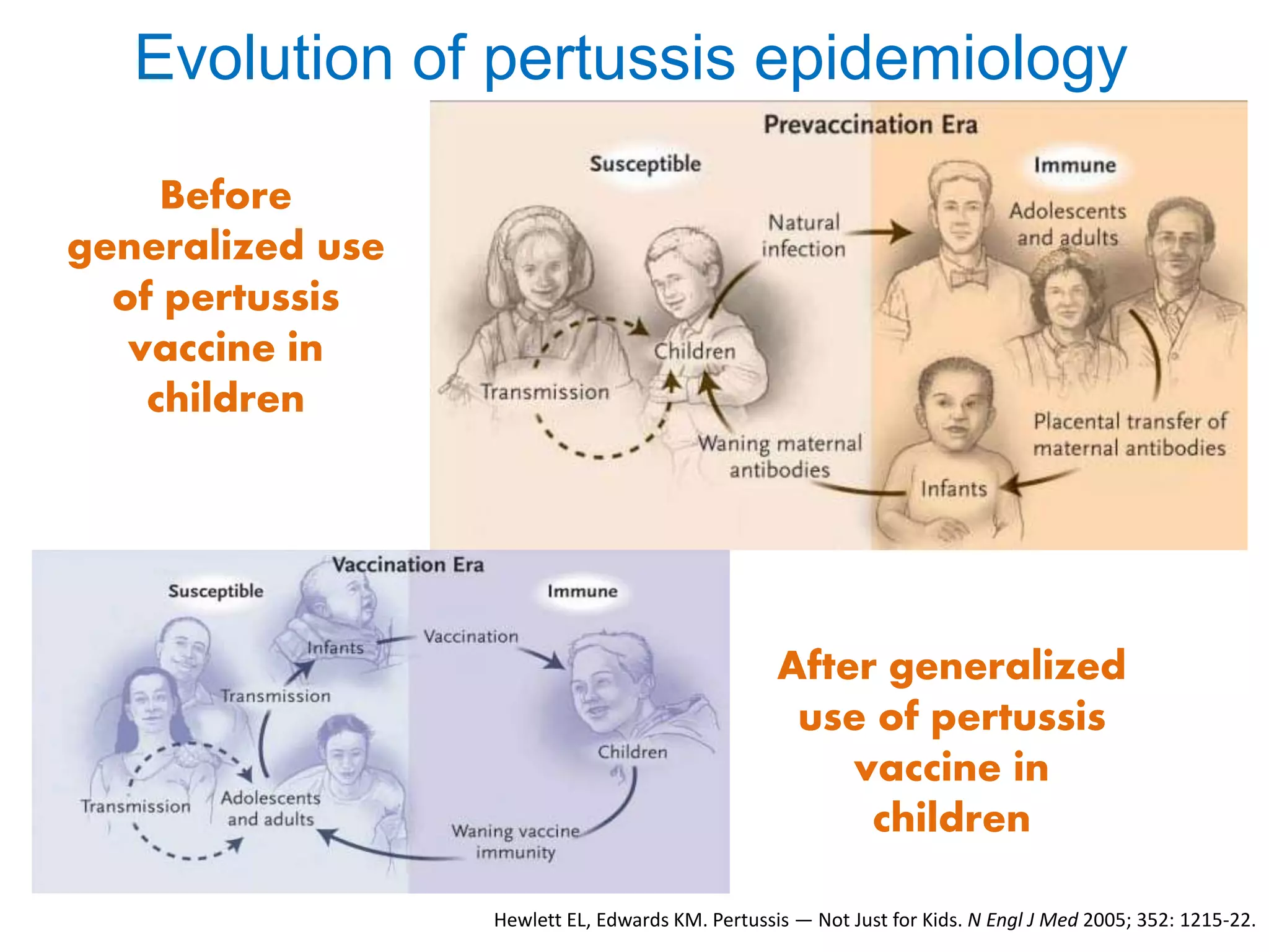 Current challenges in pertussis prevention gaurav gupta - sept 2016 | PPT