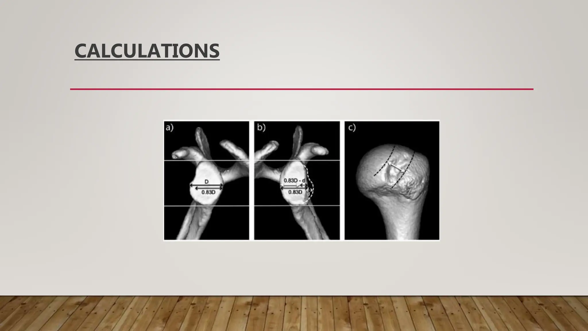 current cocept on shoulder dislocation.pptx