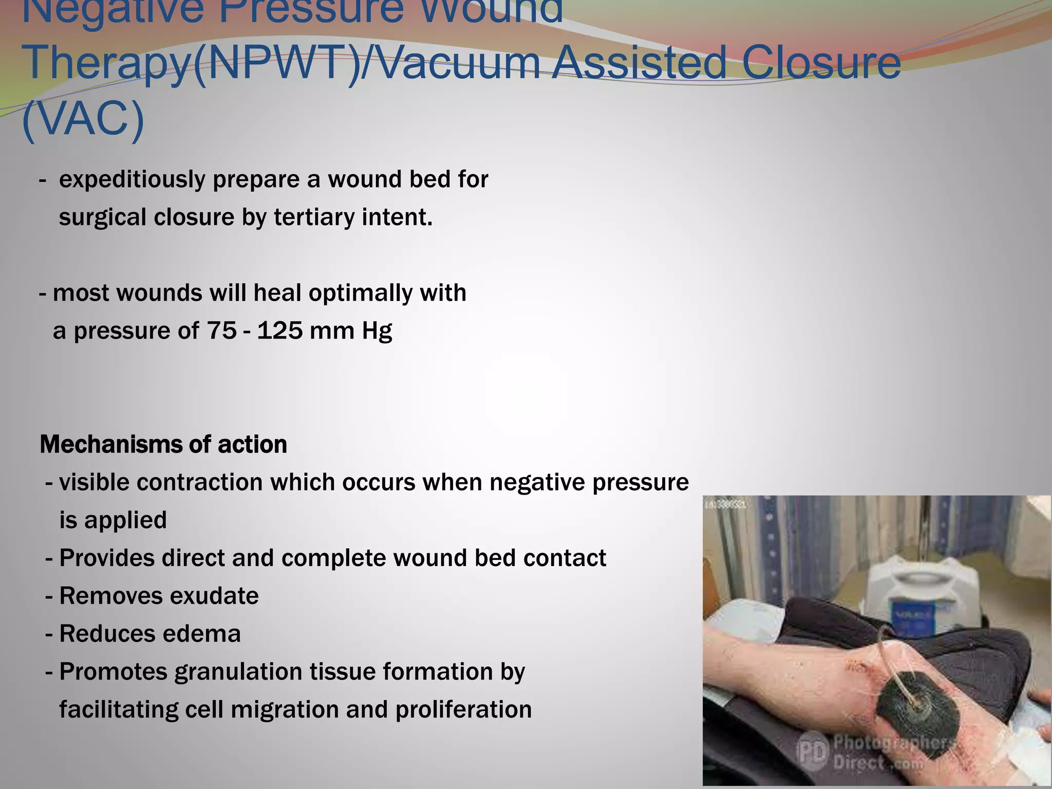 Current concept in Wound care | PPTX