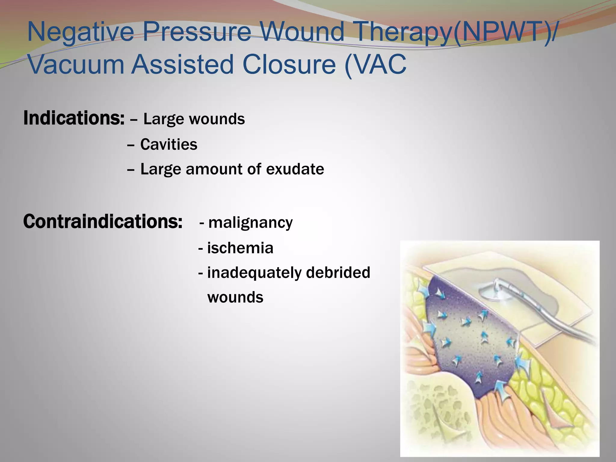 Current concept in Wound care | PPTX