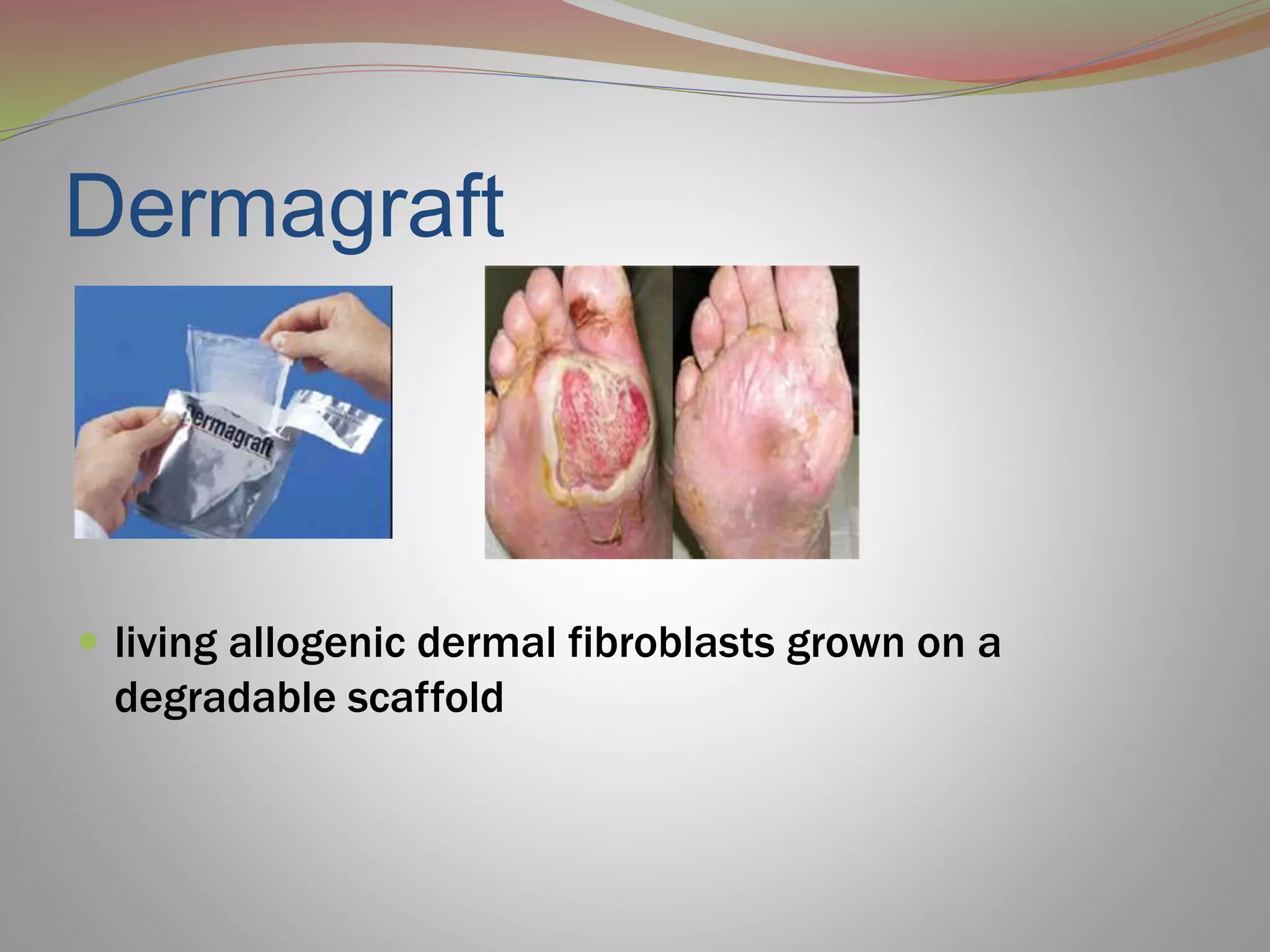 Current concept in Wound care | PPTX