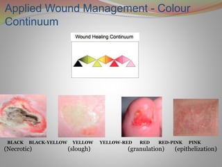 Current concept in Wound care | PPTX