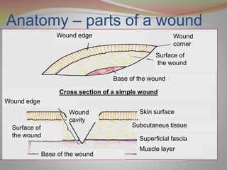 Current concept in Wound care | PPTX