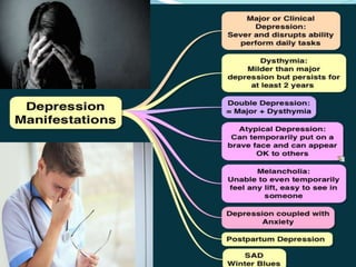 Current concept of depression management | PPT