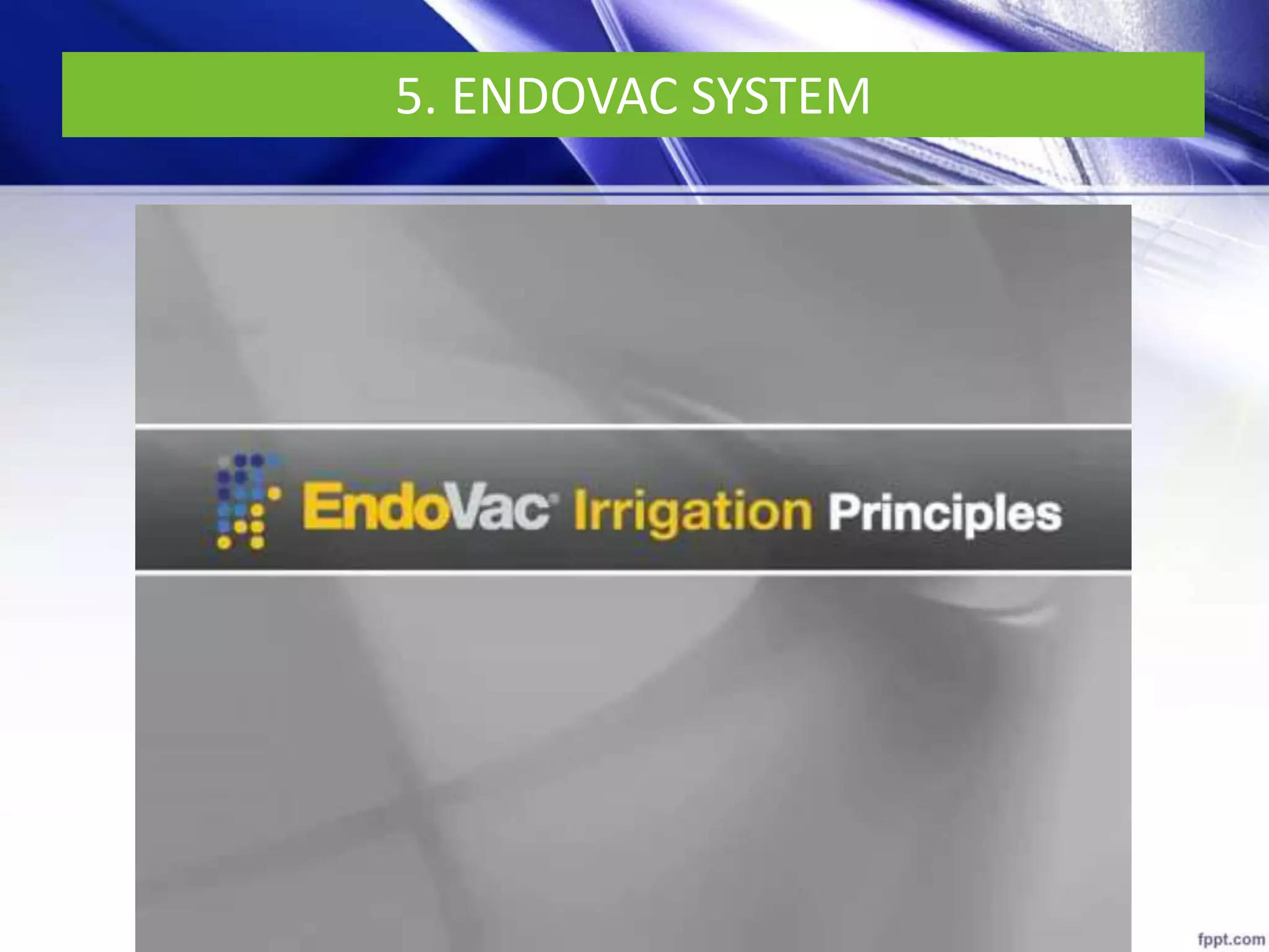 Current concept of endodontic irrigation | PPTX