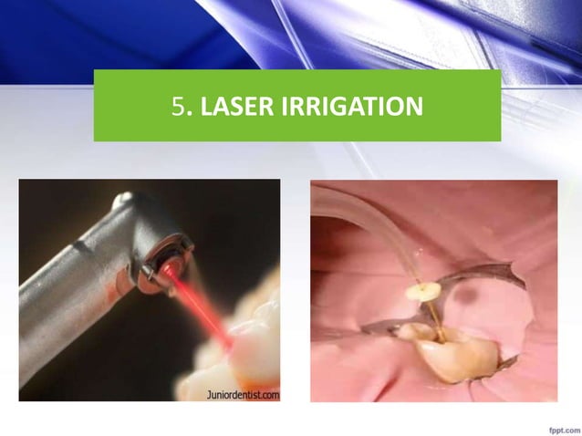 Current concept of endodontic irrigation | PPTX | First Aid | Injuries