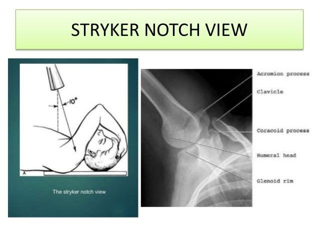 Current concepts in the management of shoulder instability