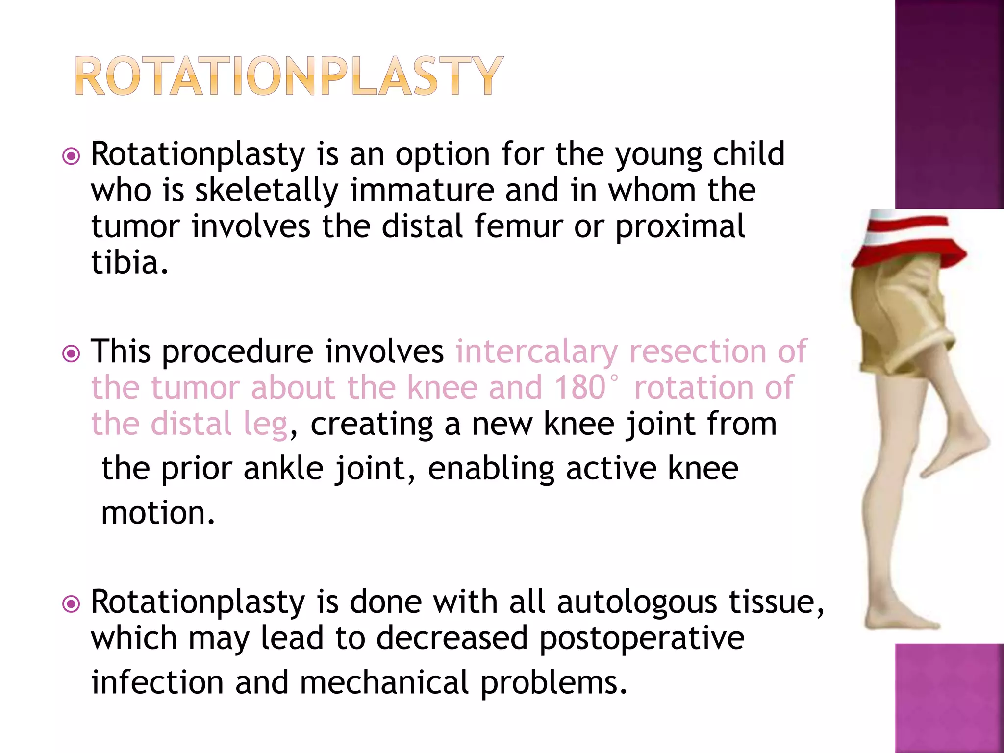 CURRENT CONCEPTS IN TREATMENT OF OSTEOSARCOMA & SKELETAL.pptx | Bone ...
