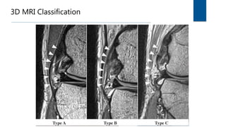 Current Concepts in Orthopedic Sports Medicine | PPTX