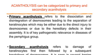 Current concepts of pemphigus with a deep insight into its molecular ...