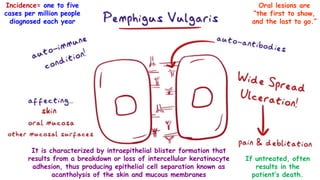 Current concepts of pemphigus with a deep insight into its molecular ...