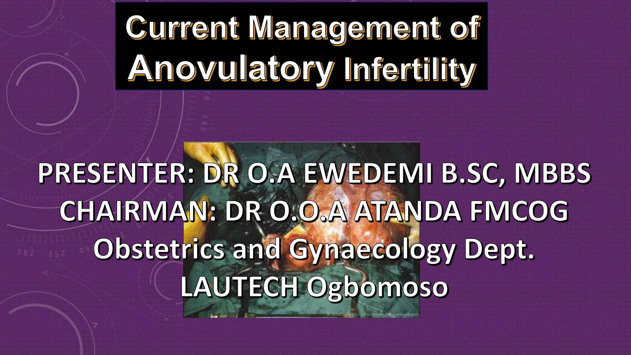 Current Management of Anovulatory Infertility | PPTX