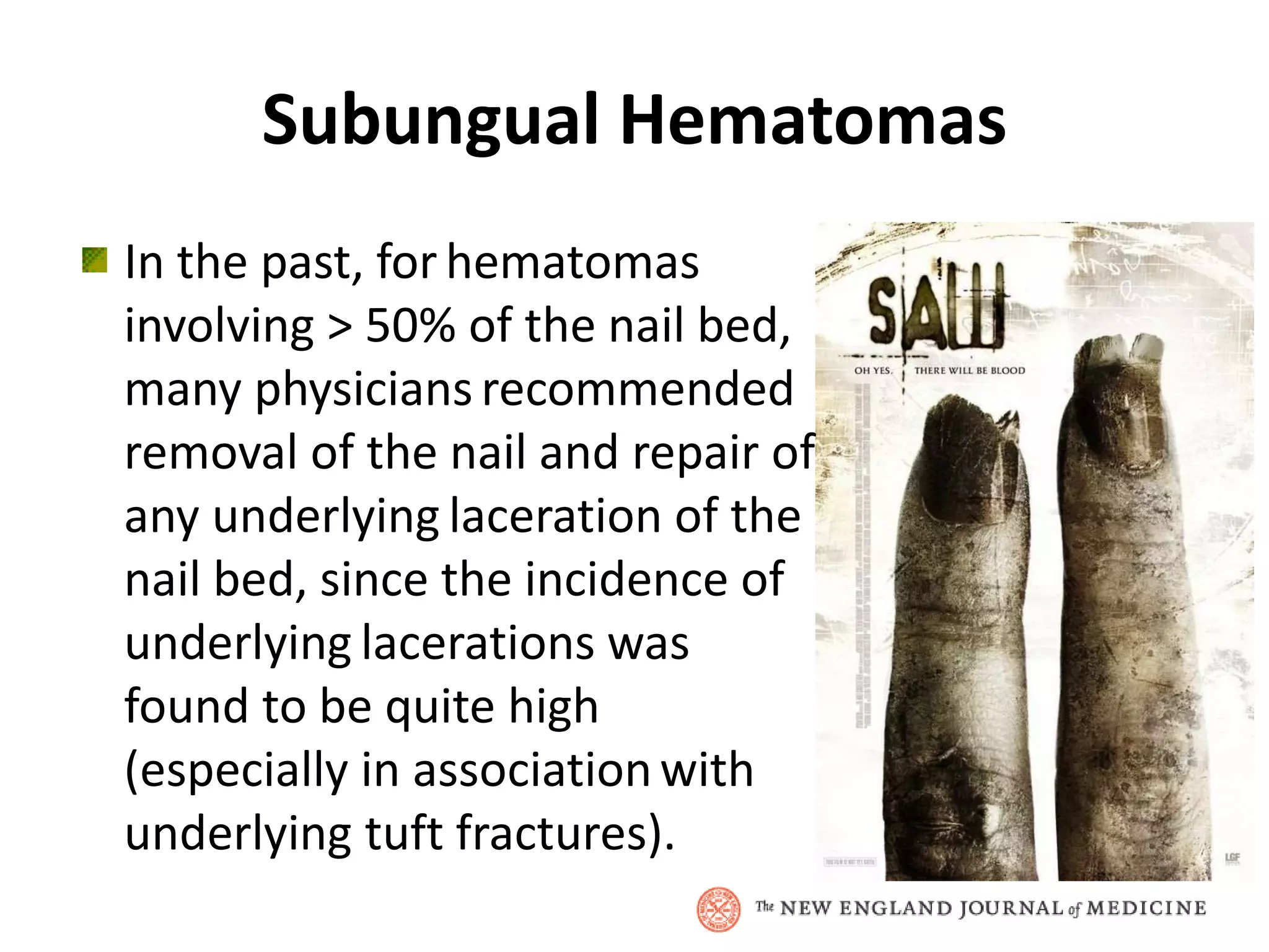 Current Management of Acute Cutaneous Wounds | PPTX
