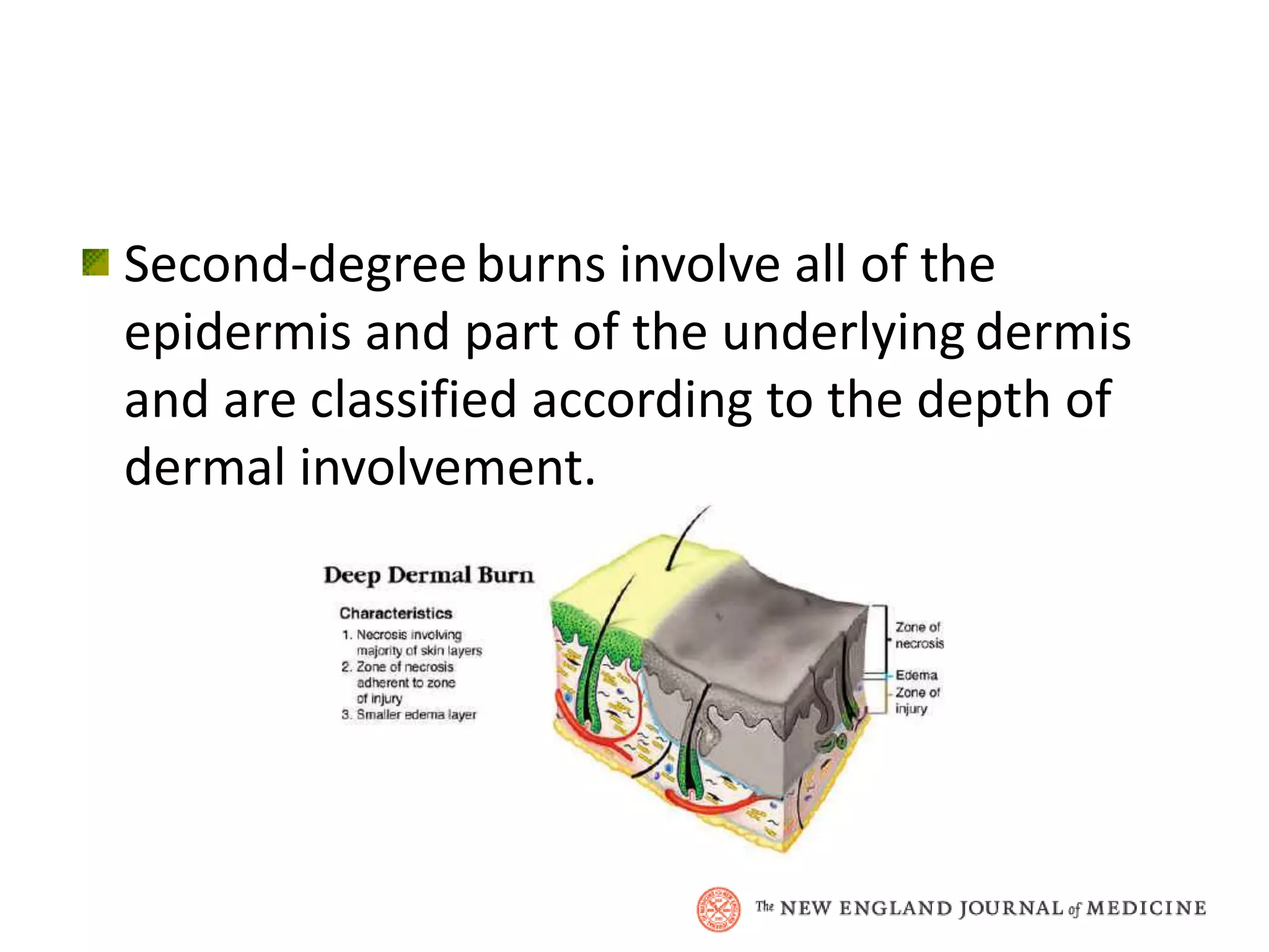 Current Management of Acute Cutaneous Wounds | PPTX