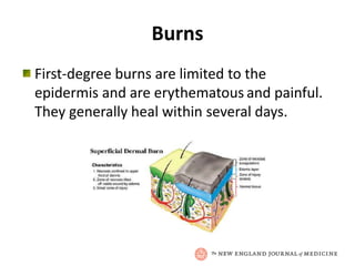 Current Management of Acute Cutaneous Wounds | PPTX