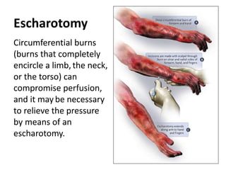 Current Management of Acute Cutaneous Wounds | PPTX