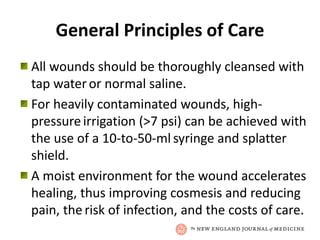 Current Management of Acute Cutaneous Wounds | PPTX