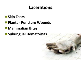Current Management of Acute Cutaneous Wounds | PPTX