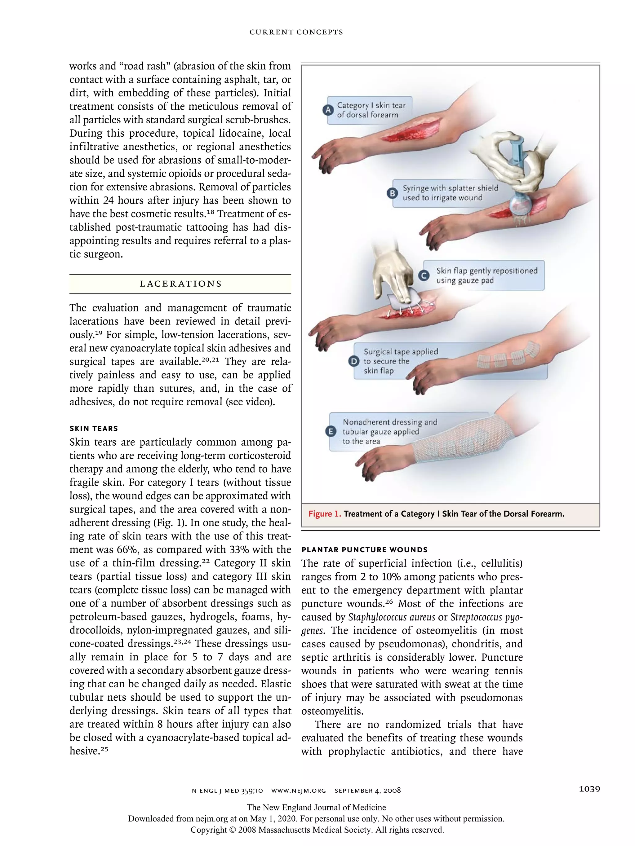 Current management of acute cutaneous wounds nejm | PDF