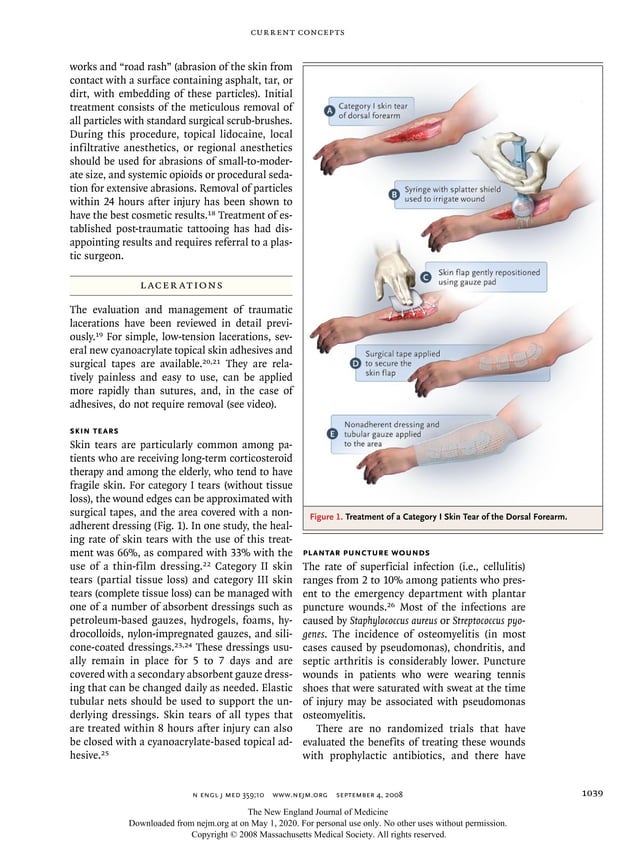 Current management of acute cutaneous wounds nejm | PDF