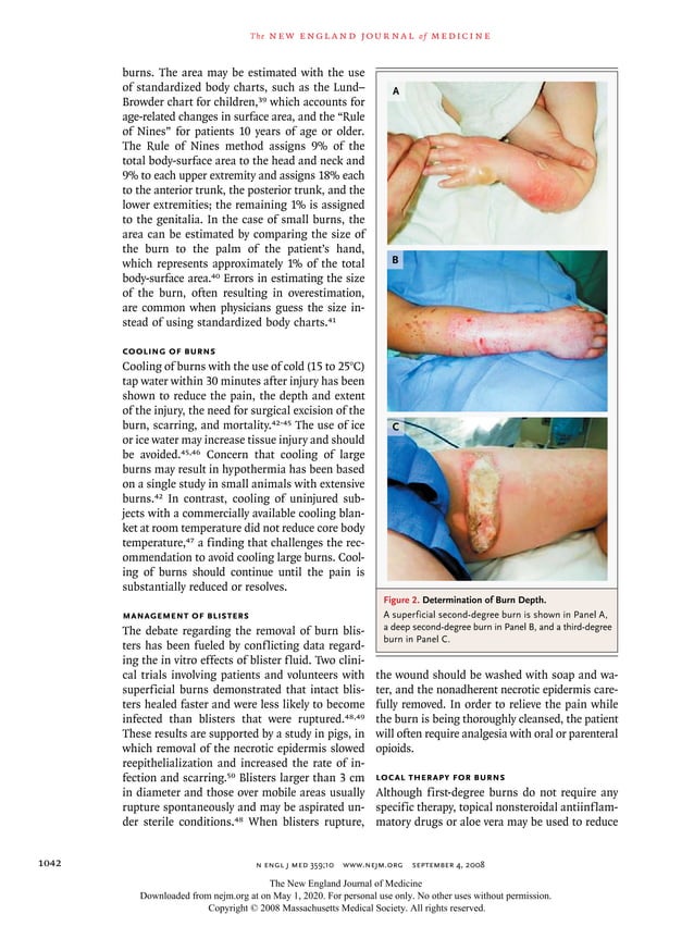 Current management of acute cutaneous wounds nejm | PDF