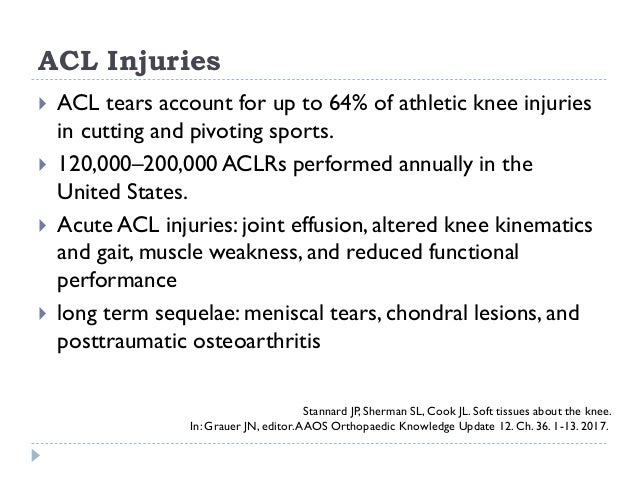 Current management of ACL injury 2017