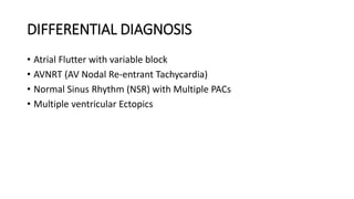 Current management of atrial fibrillation | PPTX