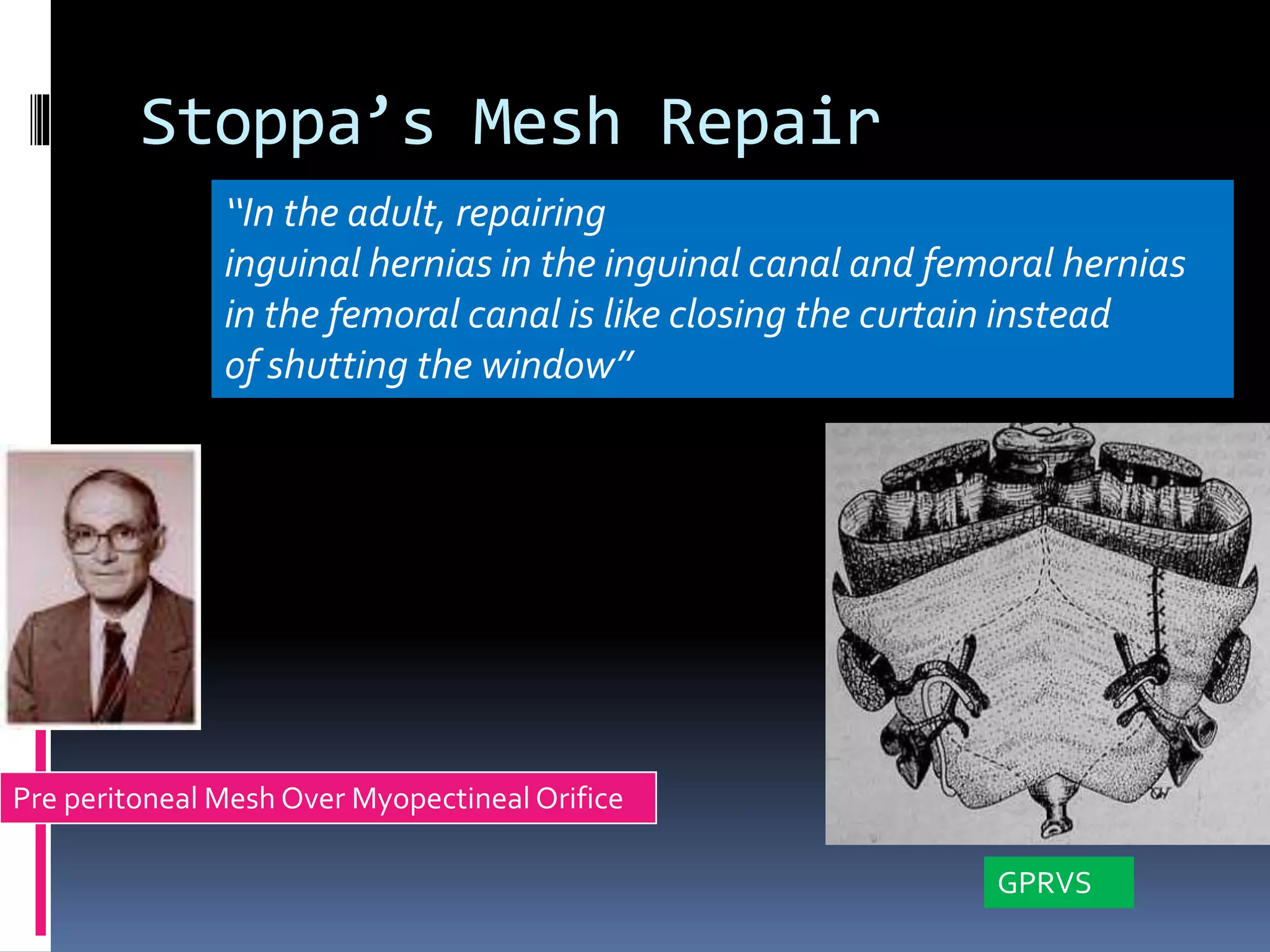 Current management of incisional hernia | PPTX