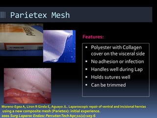 Current management of incisional hernia | PPTX