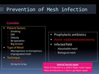 Current management of incisional hernia | PPTX