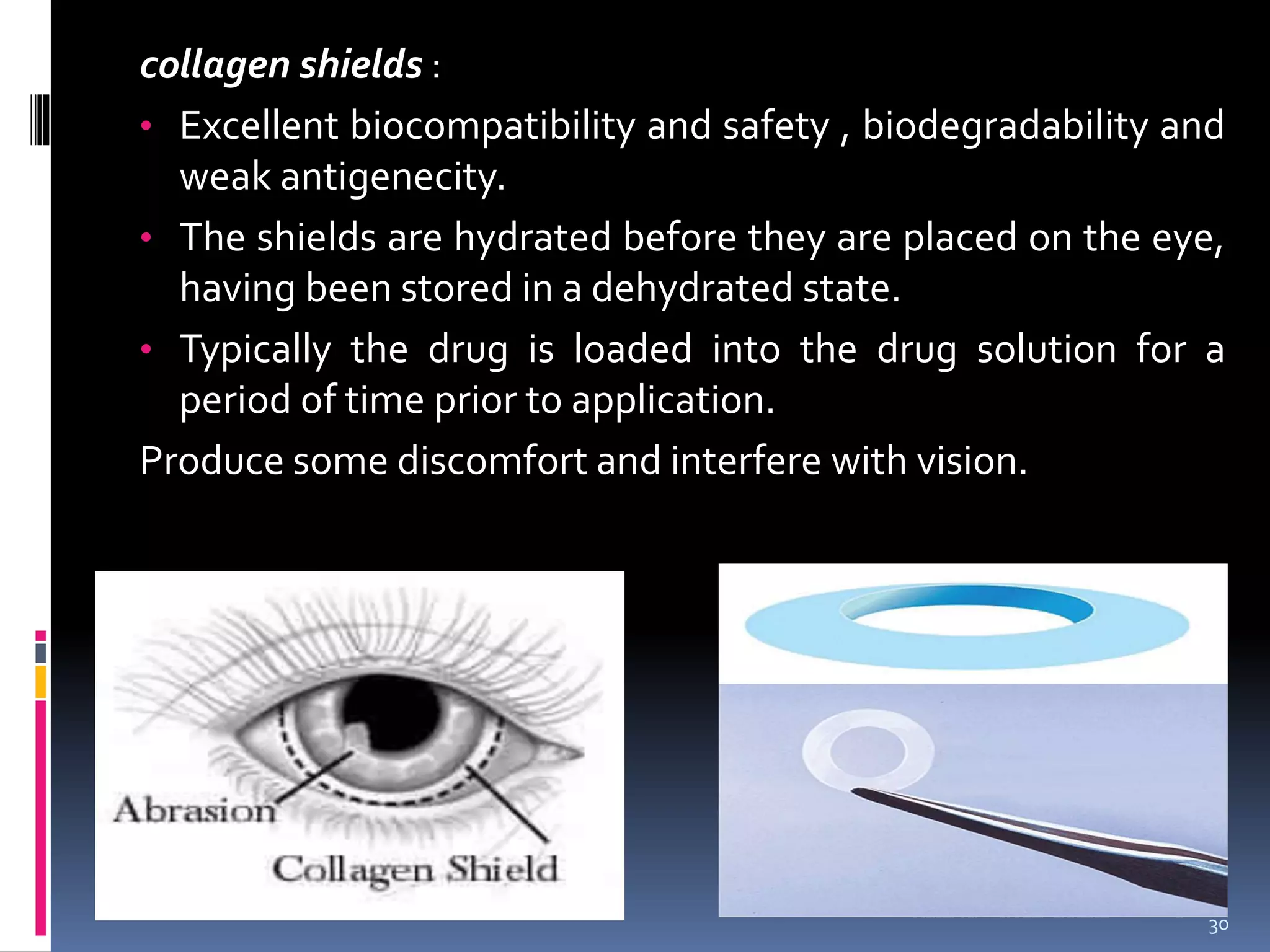 OCCULAR DRUG DELIVERY SYSTEM | PPTX