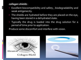 OCCULAR DRUG DELIVERY SYSTEM | PPTX