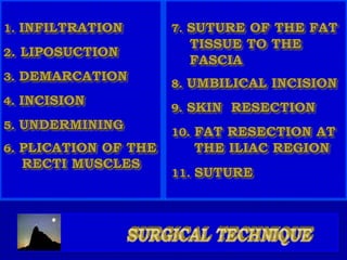 ABDOMINOPLASTY.ppt