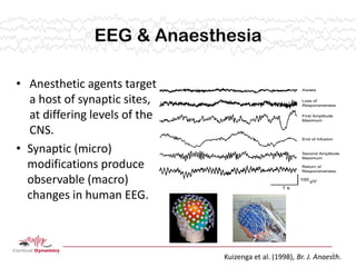 Current state of intra operative cerebral monitors | PDF