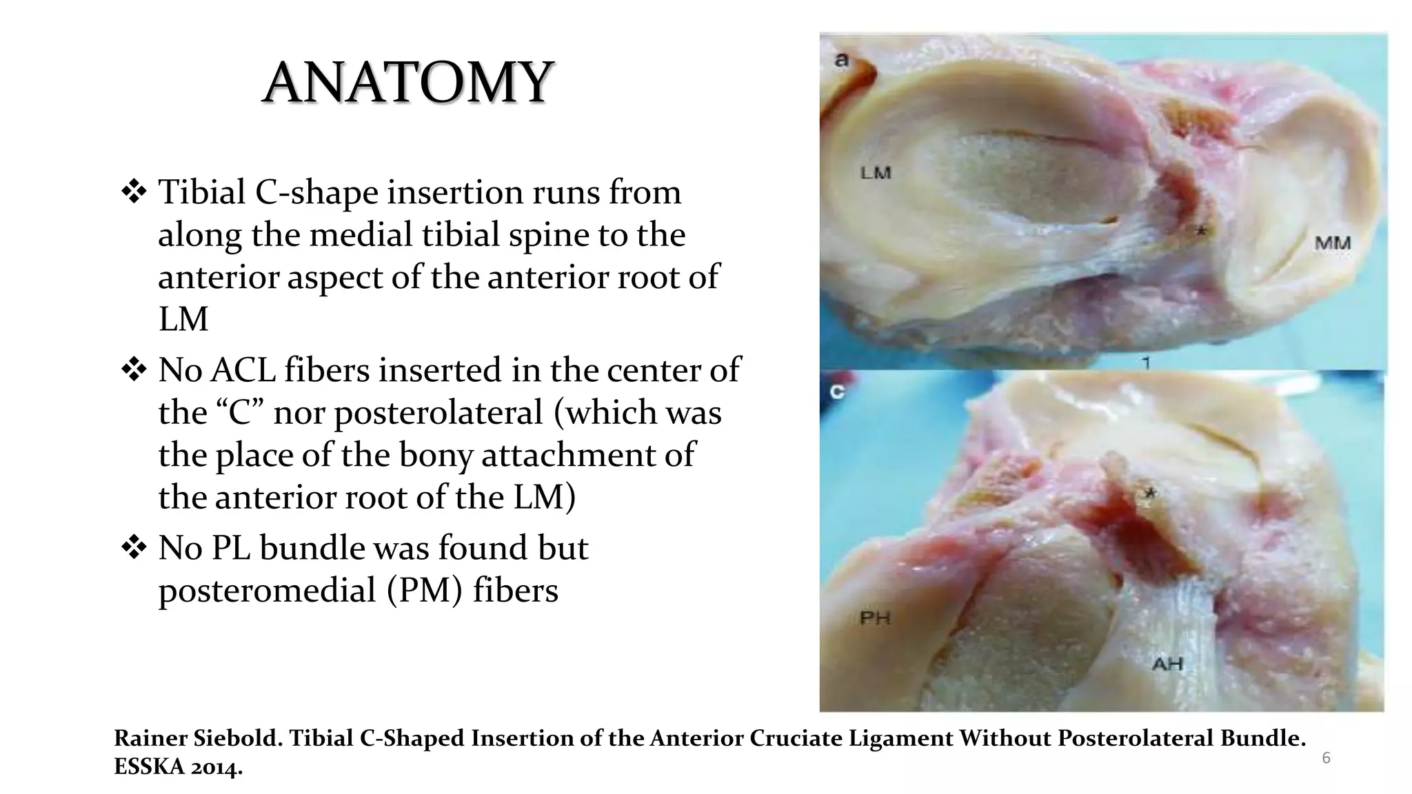 Current trends in acl surgery | PPTX