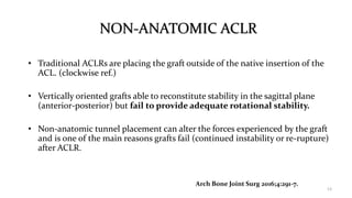Current trends in acl surgery | PPT
