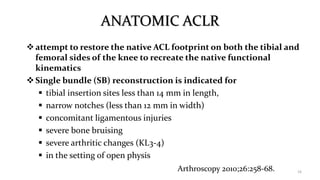 Current trends in acl surgery | PPT