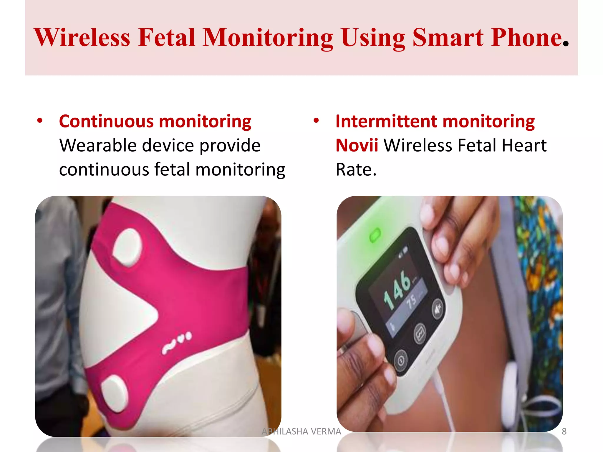 Current trends in midwifery & obstetrical nursing | PPTX