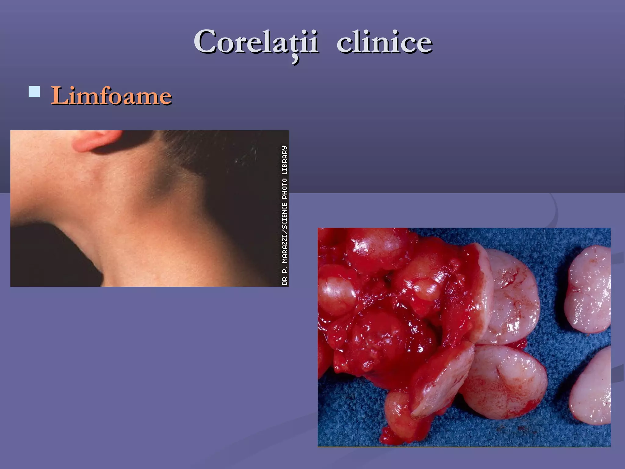 Curs 10-histo-organe-limfoide-periferice | PPT