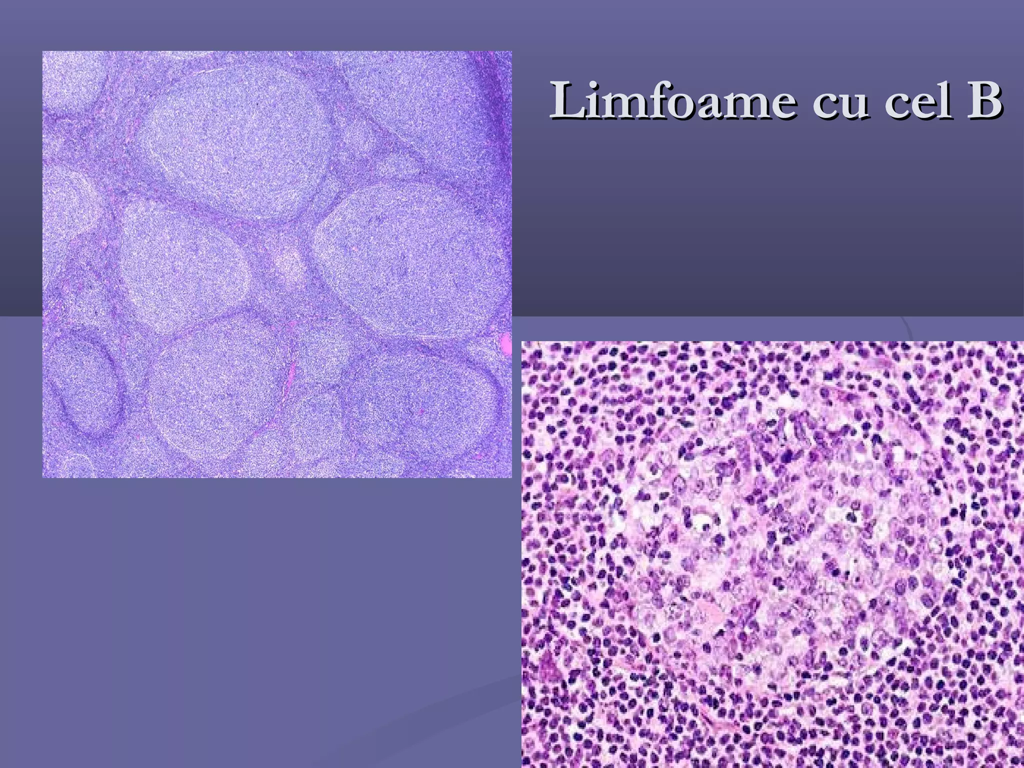 Curs 10-histo-organe-limfoide-periferice | PPT