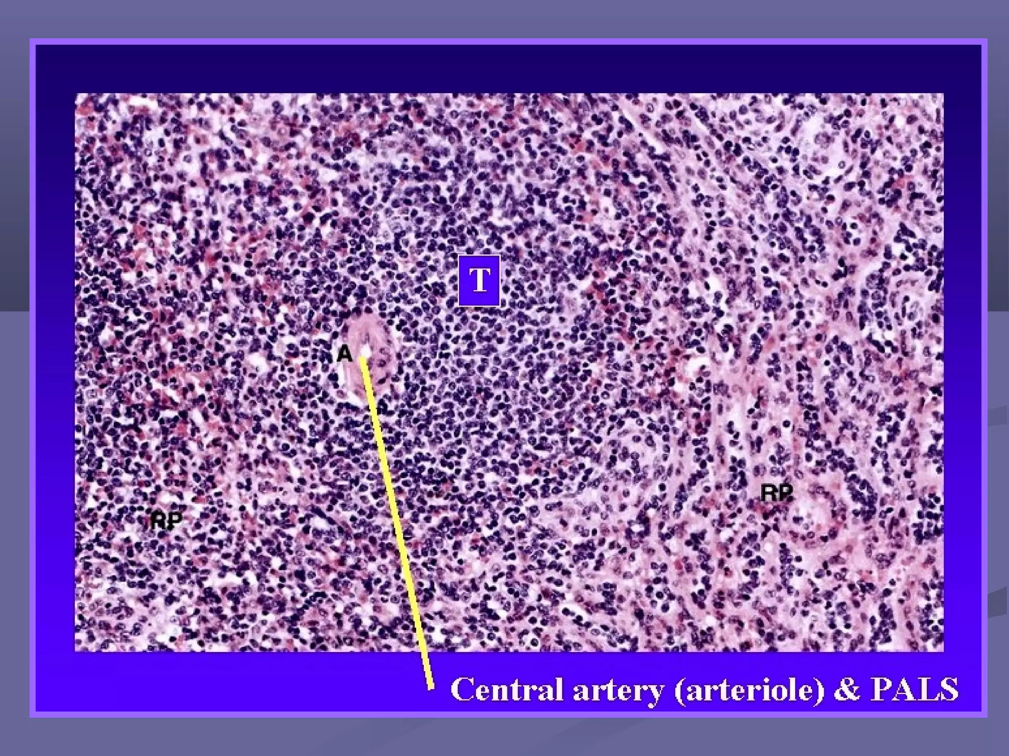 Curs 10-histo-organe-limfoide-periferice | PPT