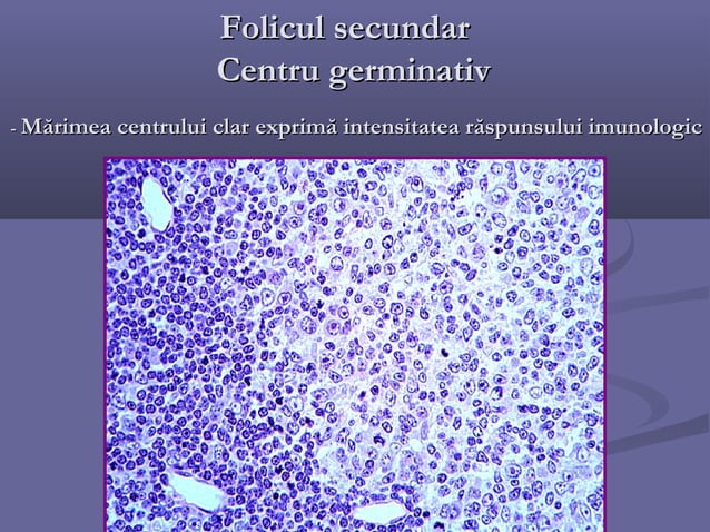 Curs 10-histo-organe-limfoide-periferice | PPT