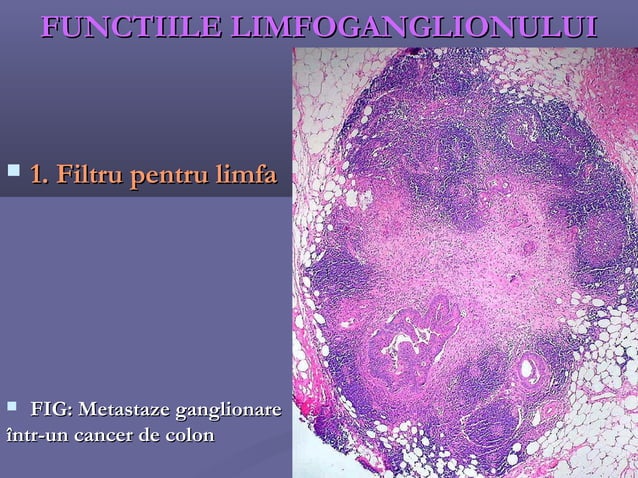 Curs 10-histo-organe-limfoide-periferice | PPT